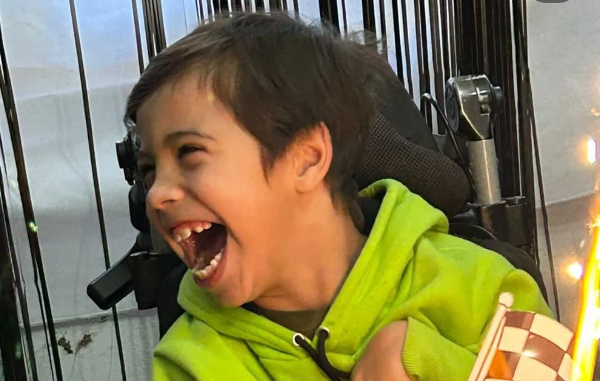 Milo necesita nuestra ayuda para su tratamiento en México – Cordon Plus ...